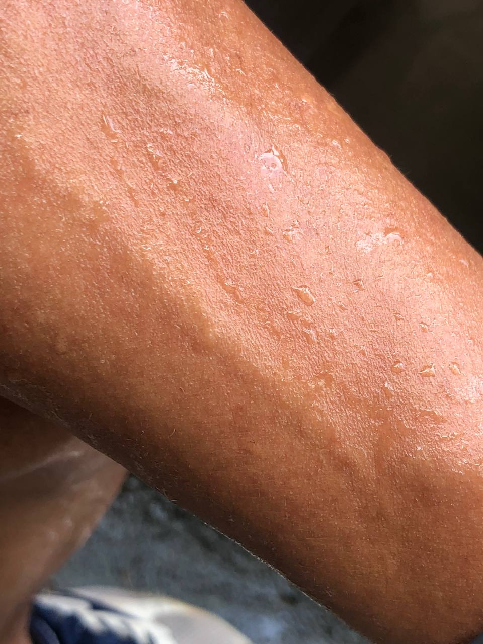 防疫三級運動日誌 – Day 13 – T.H. Schee